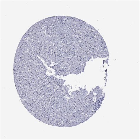 Tissue Expression Of Slc1a2 Staining In Liver The Human Protein Atlas