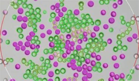 the best microscope for yeast counting