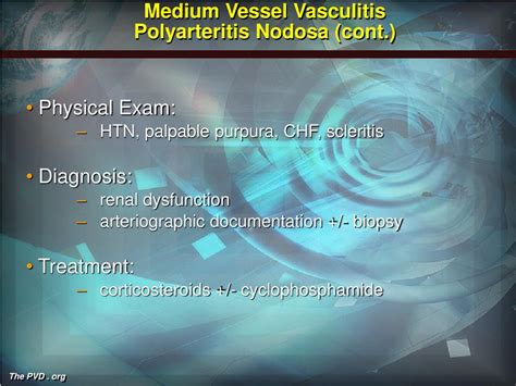 Ppt Vasculitis And Connective Tissue Disease Powerpoint Presentation