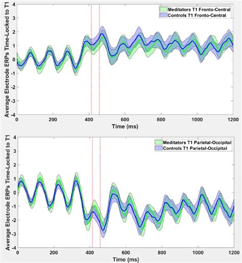 Averaged Event Related Potentials Erps Averaged Within Fronto Central Download Scientific