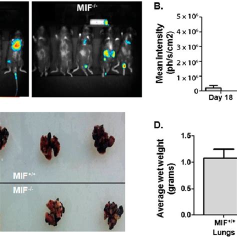 Mif Deficiency Decreases Lung Metastasis In An Experimental Metastasis