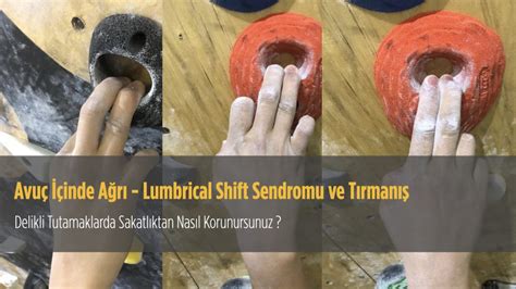 Avuç İçinde Ağrı Lumbrical Shift Sendromu Ve Tırmanış Outdoorklinik