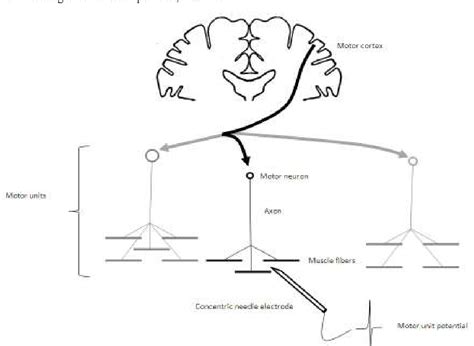 Figure 1 From Decomposition Of Motor Unit Firing Pattern Using Kalman