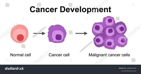 Cancer Development Normal Cells Transformed Into Stock Vector Royalty