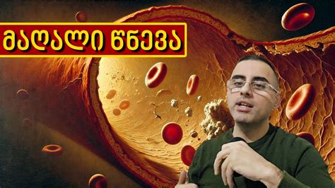 როგორ ამოვიცნოთ მაღალი წნევა ადრეულად ჰიპერტენზიის მკურნალობა Youtube