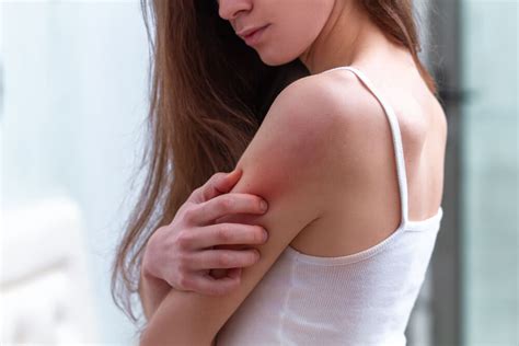 What Can Cause Extreme Itching Without A Rash VSM Pharmacy