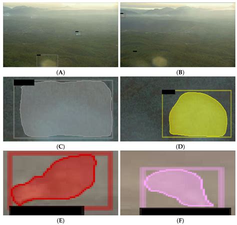 Examples Of True And False Positives Detected And Their Segmentation Download Scientific