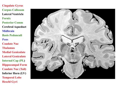PPT Cortex Cingulate Gyrus Precentral Gyrus Postcentral Gyrus Primary Visual Cortex