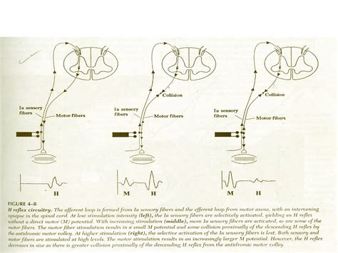 Late Responses F Wave And Hreflex Ppt