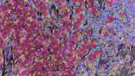 Validating A Multiplex Immunofluorescence Workflow To Improve