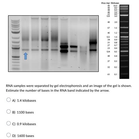 Solved Rna Samples Were Separated By Gel Electrophoresis And