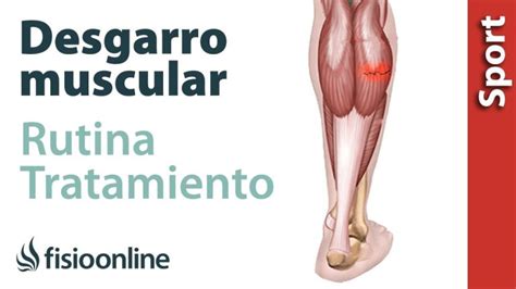Como Recuperarse De Un Tiron Muscular Actualizado Octubre 2022