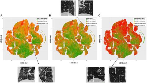 T Distributed Stochastic Neighbor Embedding T Sne Visualizations Of Download Scientific