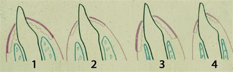Morphological Classification From 1 To 4 Of Maynard And Wilson 1980 Download Scientific