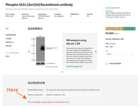 分不清磷酸化位点怎么办？这些命名要点帮你轻松通关！ 知乎