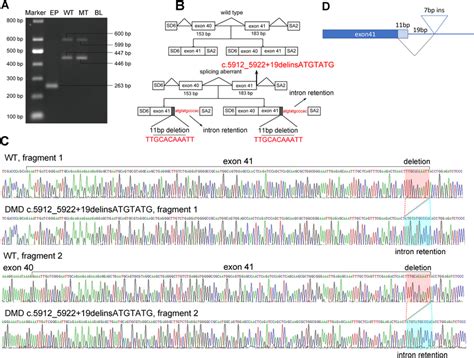 Pathogenic Analysis Of The Hemizygous Splicing Mutation In Dmd By