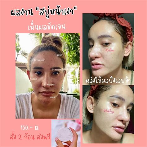 ส บู่ ห น้ า เ ครีมวิตามิน ครีมบำรุงหัวเชื้อเร่งผิวขาว