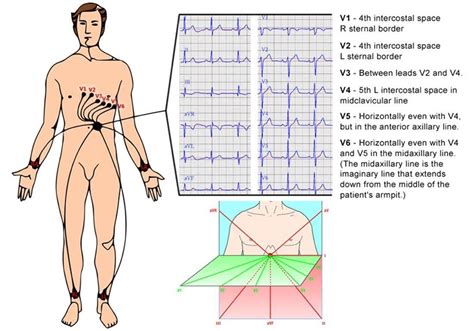لما قلت لكم ان قراءة تخطيط القلب صارت لعبتي ترا كنت كذابه بس لعبتي يعني