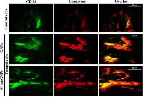 Gnps And Silica Gnps Increased Killing Of Cancer Cells Through