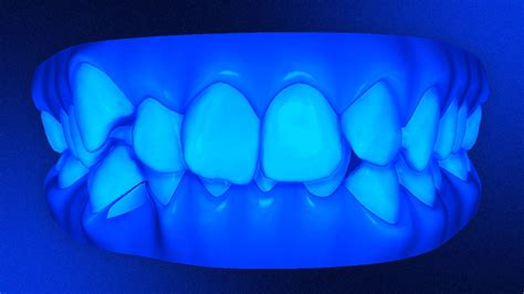 Premium Clinical Deep Dive 79 Extraction Premium Clinical Deep Dive 79 Extraction