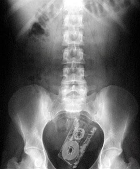 Pinterest X Ray Strange Human Body
