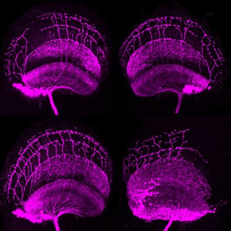 The Stochastic Aspect Of Brain Development Paris Brain Institute