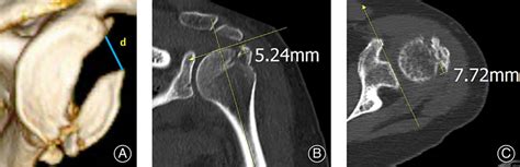 Method To Measure The Displacement Of Fractures A The Displacement Download Scientific