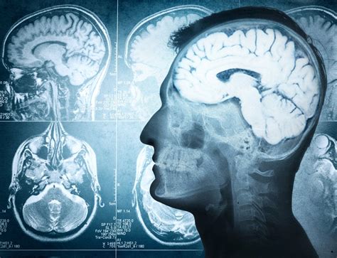 Study Identifies Brain Process Vital To Short Term Memory