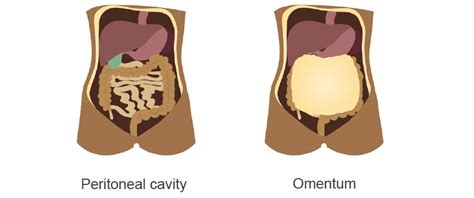Abdominal Ct Peritoneal Cavity • Litfl • Radiology Library