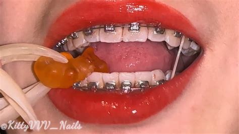 Crushing Gummy Bears With My Sharp White Teeth With Braces And Long