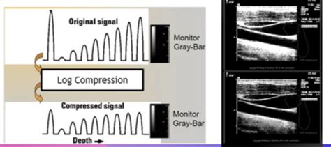 Pulsed Echo Instrumentation Ch Flashcards Quizlet