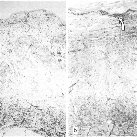 A Light Microscopic Cross Sectional View Showing The Typical Download Scientific Diagram