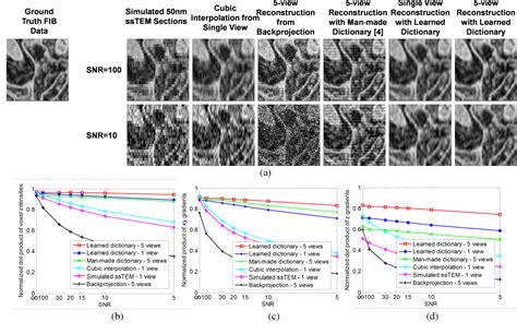 Figure 1 From Electron Microscopy Reconstruction Of Brain Structure Using Sparse Representations