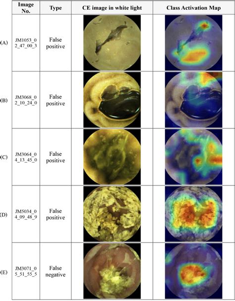 Examples Of Several Class Activation Maps Of Misclassified Images A Download Scientific