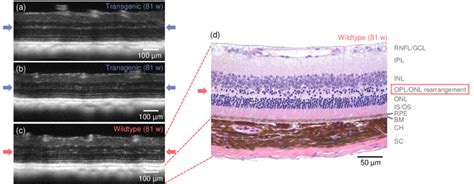 Demonstration Of Retinal Layer Abnormalities The Outer Plexiform Layer Download Scientific