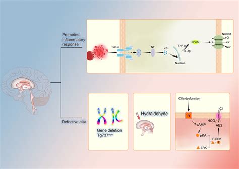 Pathology Of Choroid Plexus Epithelium The Pathological Process Of