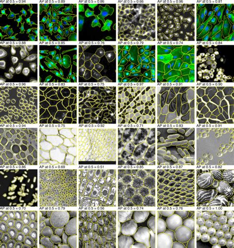 Livecell For Ai Assisted Cell Segmentation
