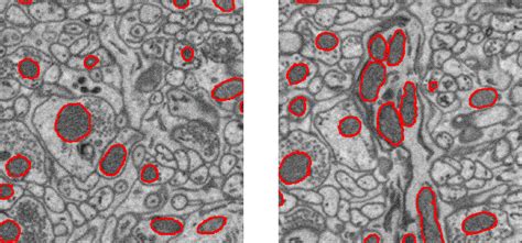 Figure 1 From Segmentation Of Mitochondria In Electron Microscopy Images Using Algebraic Curves
