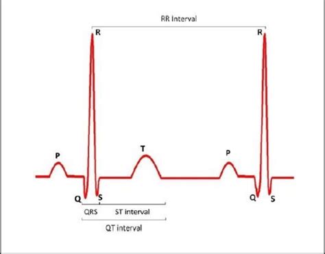 Ecg Signal Showing The Qrs Complex Region Download Scientific Diagram