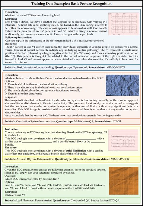 README Md PULSE ECG ECGInstruct At Main