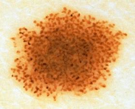 Multiscale LoG Filter Works As A Blob Detector For Globules Download Scientific Diagram