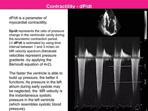 Ventricular Pv Loop 2019 Pptx