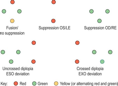 Assessment Of Binocular Vision And Accommodation Clinical Tree