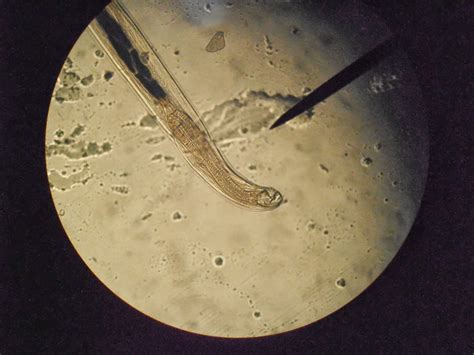 Atlas Parasitología Biologia Sanitaria Ancylostoma Spp