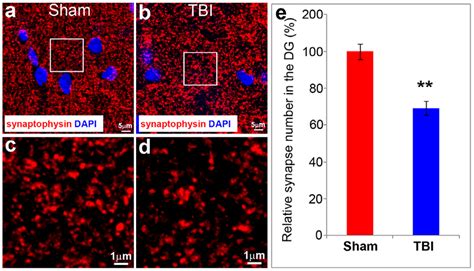Moderate Tbi Decreases The Number Of Synapses In The Injured Area