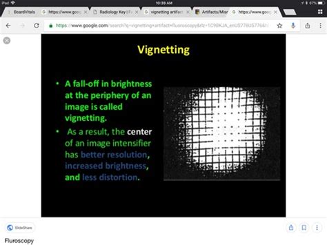 Fluoroscopy Module 11 Flashcards Quizlet