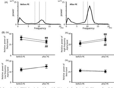 Figure 6 From Ventral Prefrontal Cortex And Serotonergic System