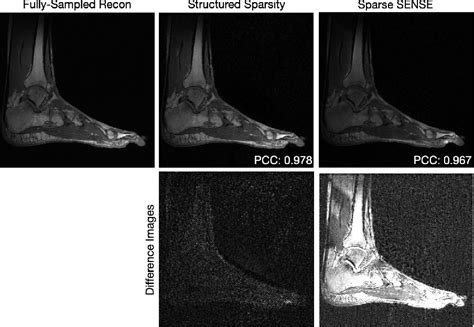 Figure 2 From Accelerated Parallel Magnetic Resonance Imaging With