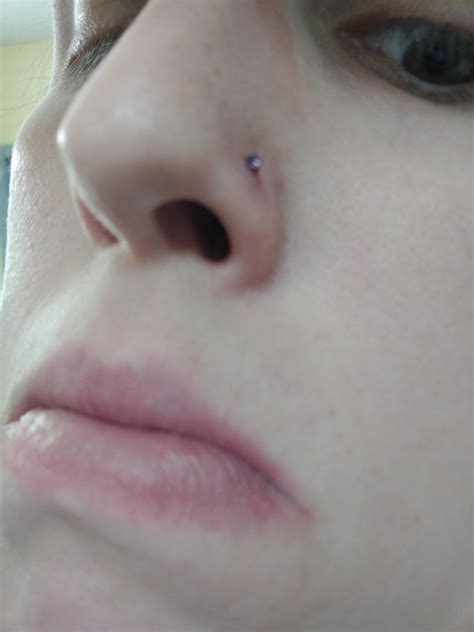Nose Piercing Infection Rpiercingadvice