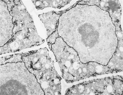 Ribosomes Electron Micrograph